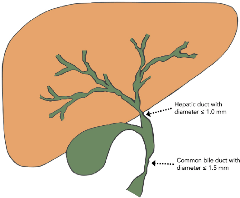 Biliary Stricture - Dr. Jenit Gandhi